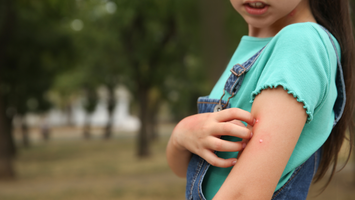 Preventing Insect Bites: Protective Clothing & Repellent for Outdoors.